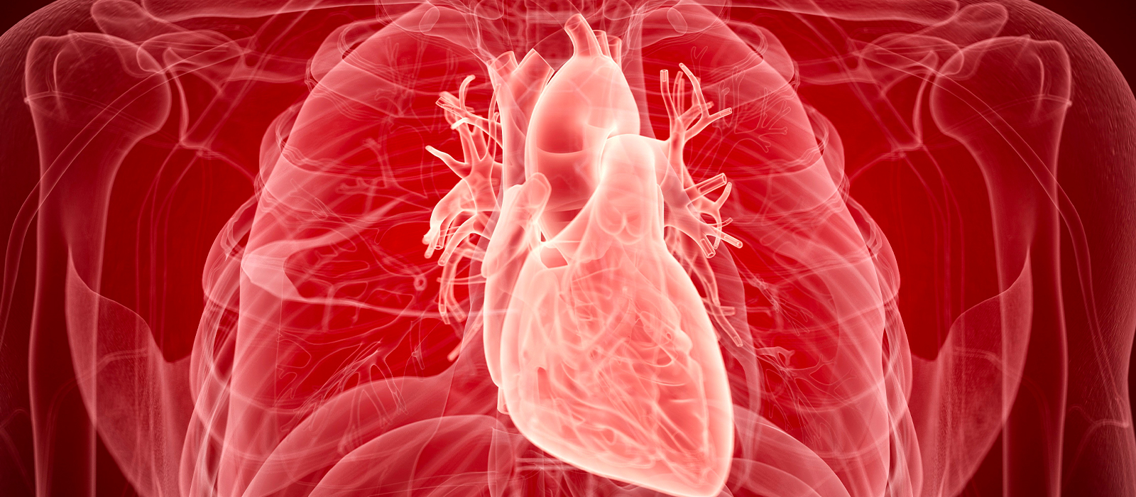 L’amylose cardiaque - FFC