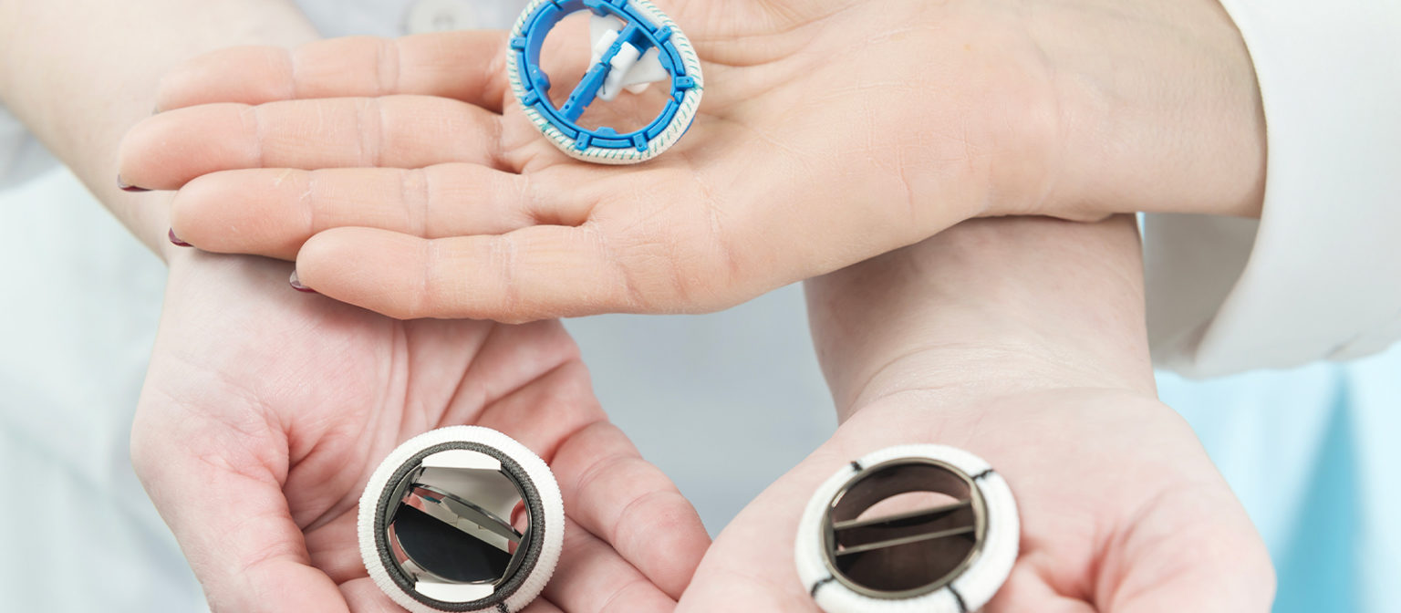 Les valvulopathies, les traitements - FFC