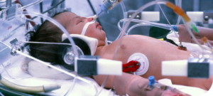 Les malformations cardiaques - FFC